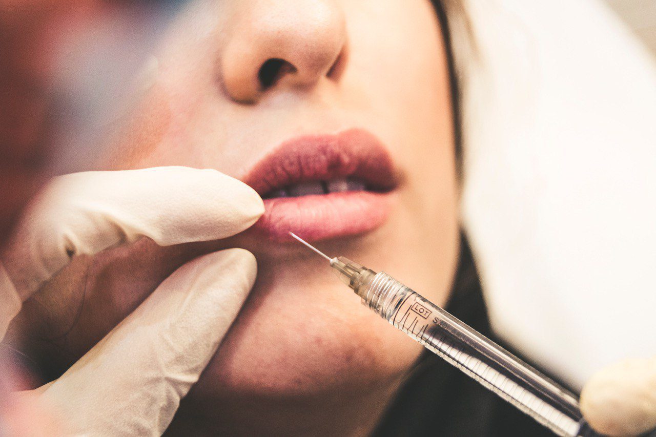 Is Filler Dangerous? Dermal Filler complications... - Simply Clinics